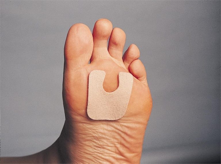 Callus Treatment and Protector Pads | BEK Medical